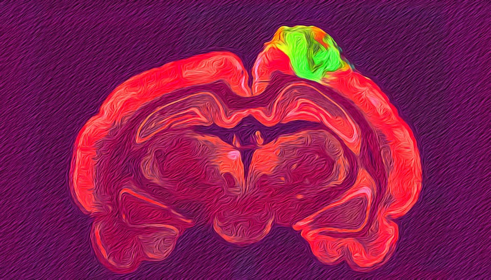 Scientists are putting human brain into rats – True News Media